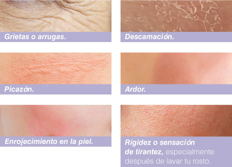 Mejora o calma la piel seca siguiendo estos pasos - IK