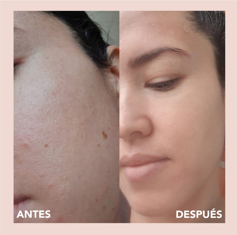 Conoce nuestro programa de testimonios.